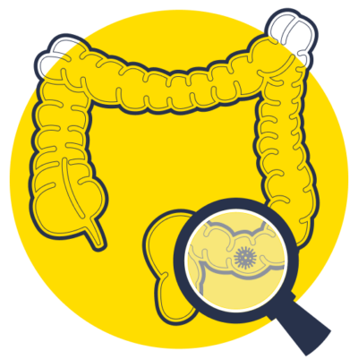 How To Prevent Colon Cancer - Lead From Behind